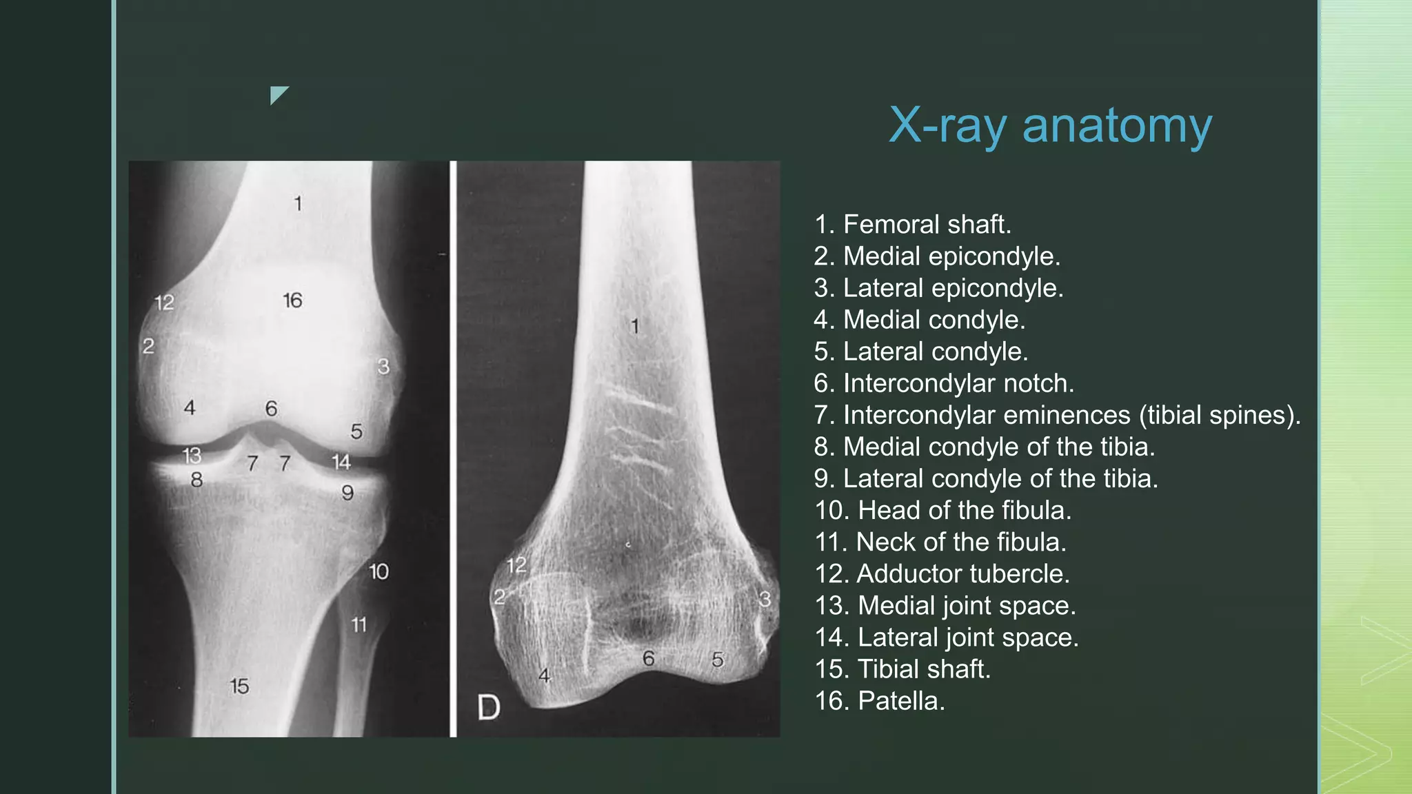 X ray knee joint | PPTX