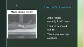X ray knee joint | PPTX