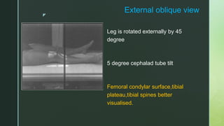 X ray knee joint | PPTX