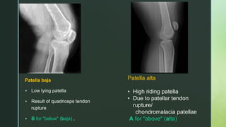 X ray knee joint | PPTX