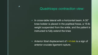 X ray knee joint | PPTX