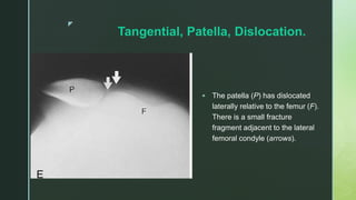 X ray knee joint | PPTX