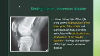 X ray knee joint | PPTX