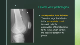 X ray knee joint | PPT