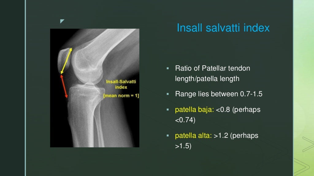 X ray knee joint