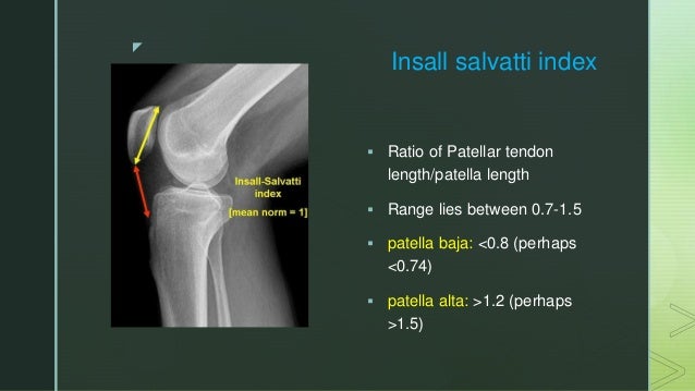 X ray knee joint