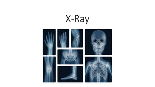 X Ray Ppt