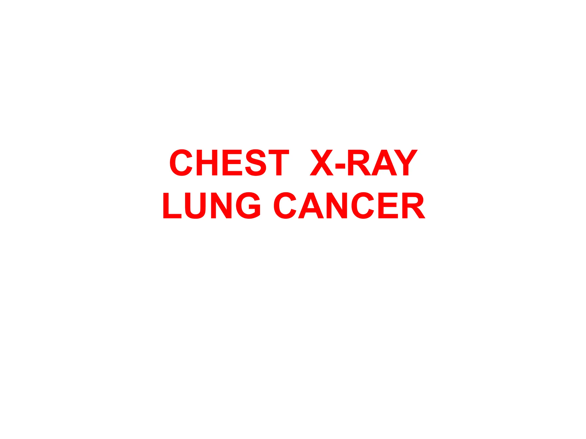 CHEST X-RAYS OF LUNGCANCER.........pptx
