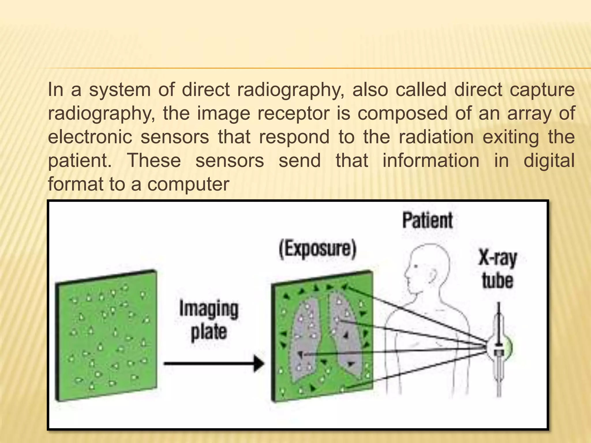 X ray machines - conventional and digital | PPTX