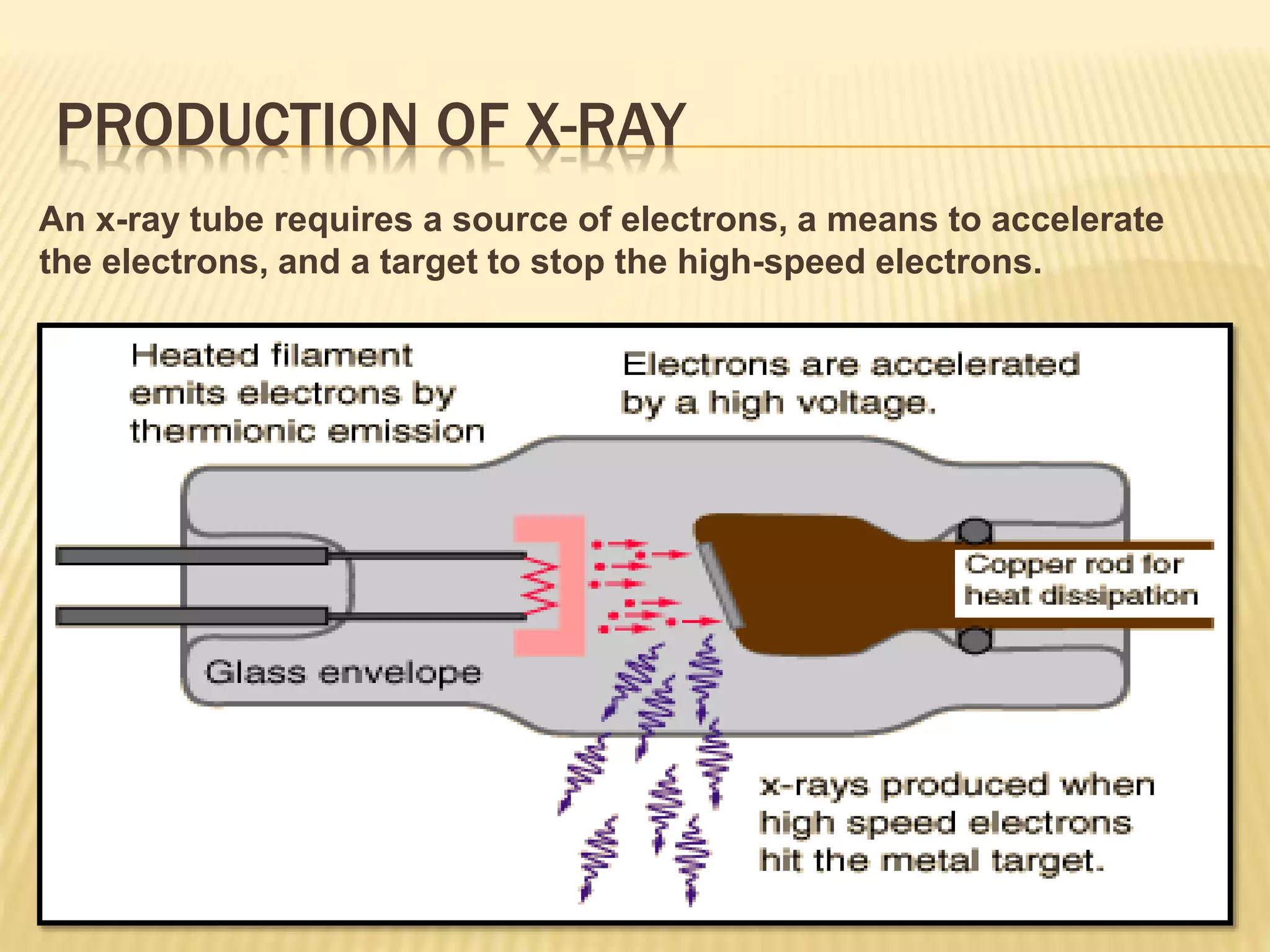 X ray machines - conventional and digital | PPTX