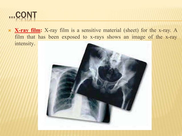 X ray machines - conventional and digital | PPTX