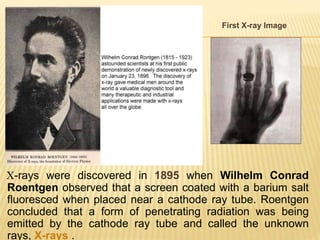 X ray machines - conventional and digital | PPTX