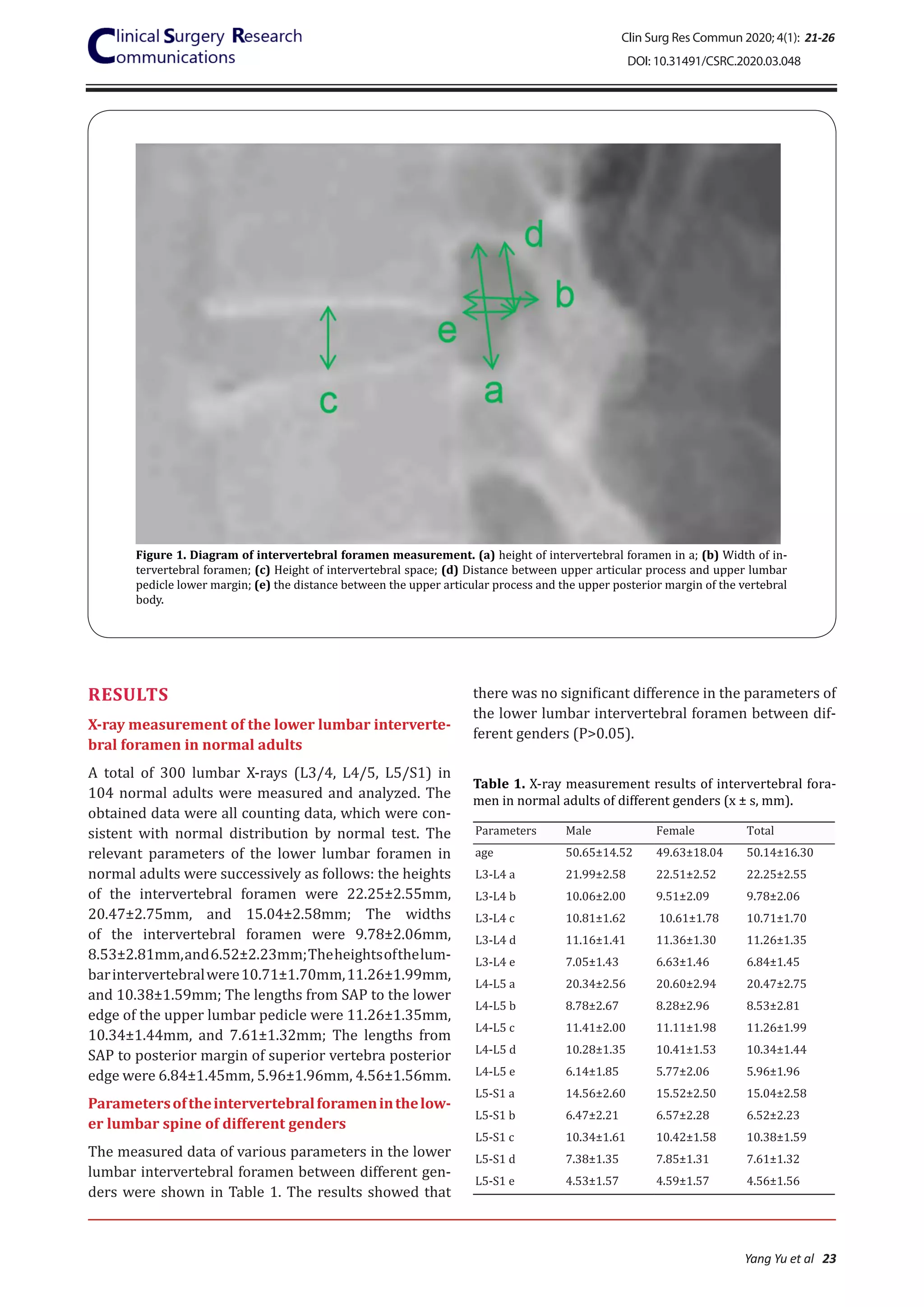 X ray measurement and analysis on parameters of intervertebral foramen ...
