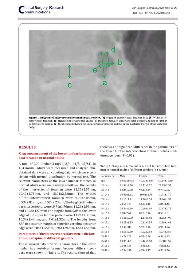 X ray measurement and analysis on parameters of intervertebral foramen ...