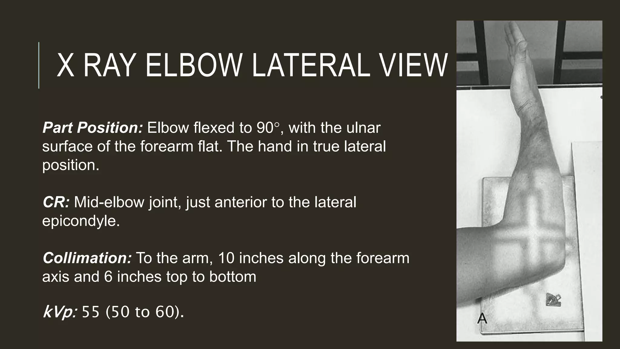 X ray of elbow joint | PPTX