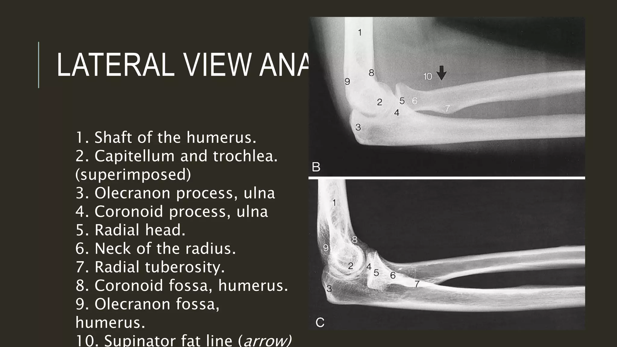 X ray of elbow joint | PPTX