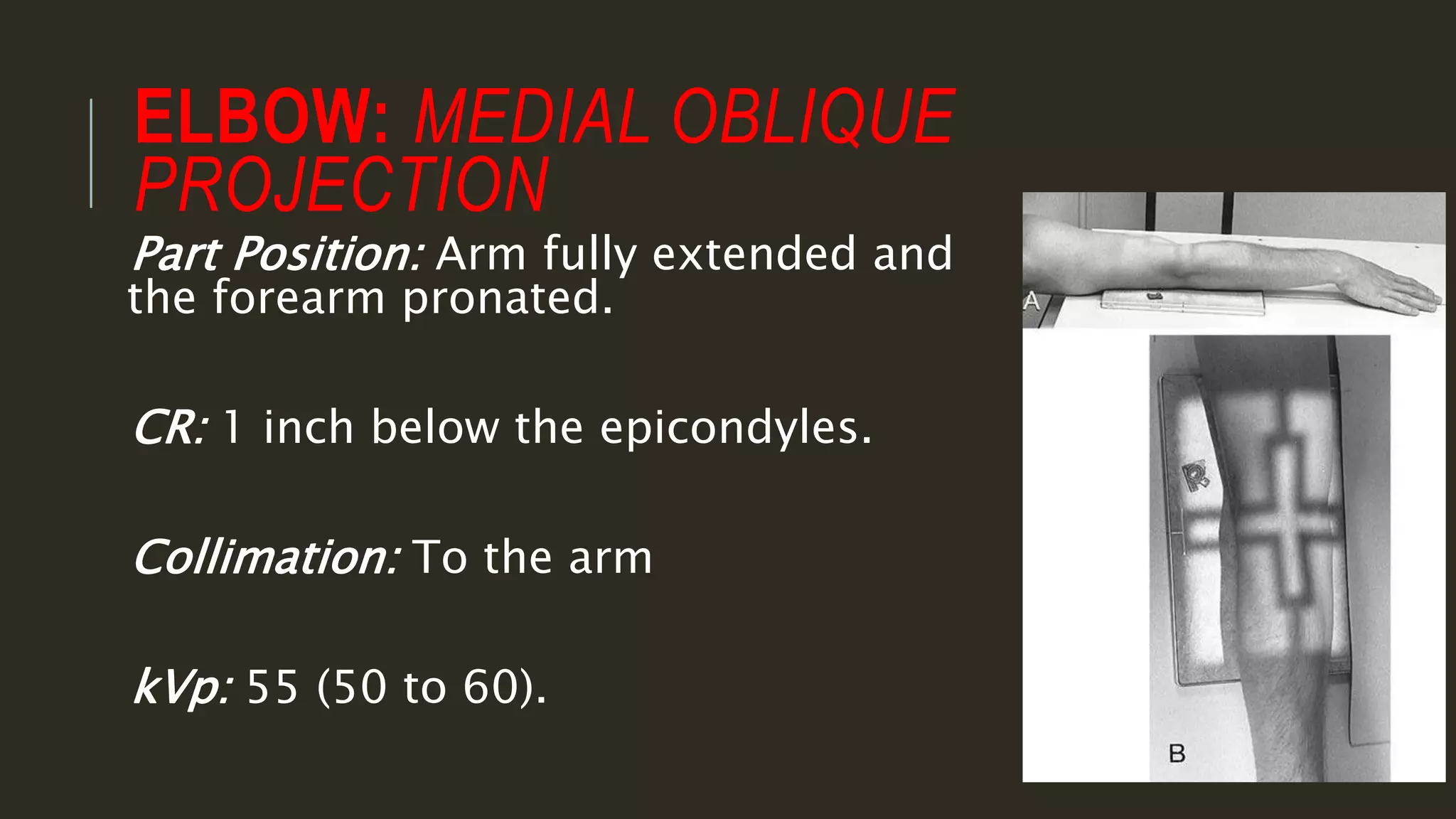 X ray of elbow joint | PPTX