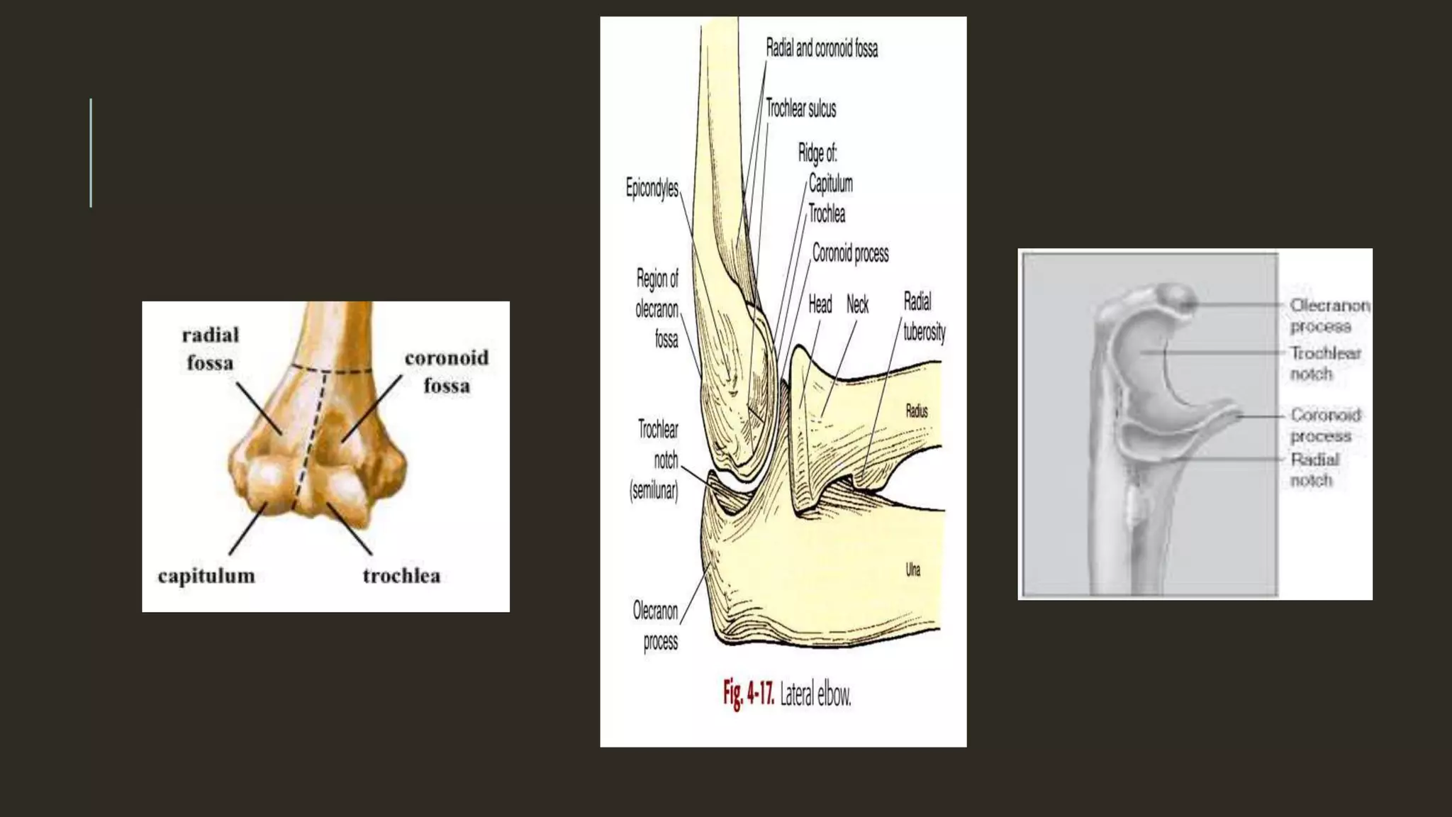 X ray of elbow joint | PPTX