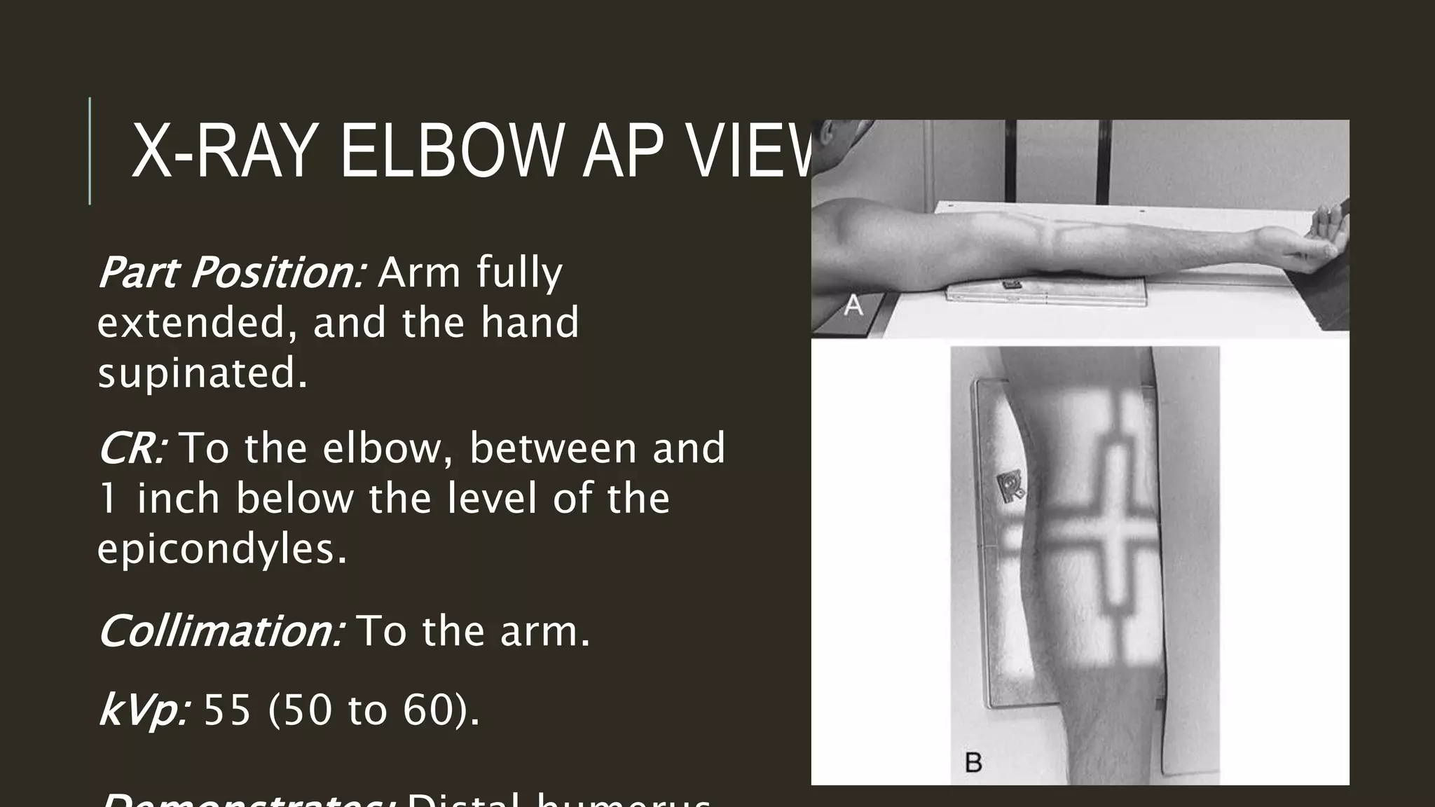 X ray of elbow joint | PPTX