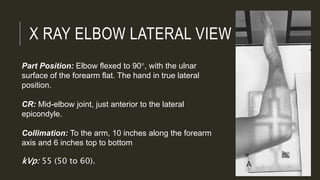 X ray of elbow joint | PPTX