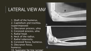 X ray of elbow joint | PPTX