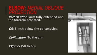 X ray of elbow joint | PPTX