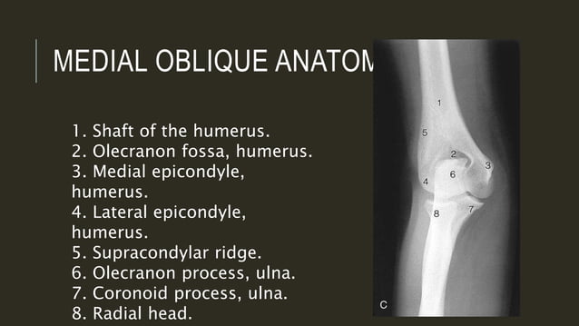 X ray of elbow joint | PPTX | Death, Injury, or Military Conflict ...