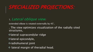 X ray of elbow joint | PPTX