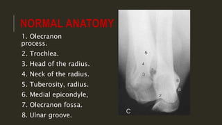 X ray of elbow joint | PPTX