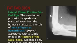 X ray of elbow joint | PPTX