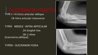 X ray of elbow joint | PPTX