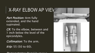 X ray of elbow joint | PPTX