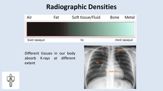 X-RAY OF THE HEART.pptx