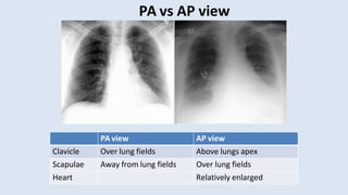 X-RAY OF THE HEART.pptx