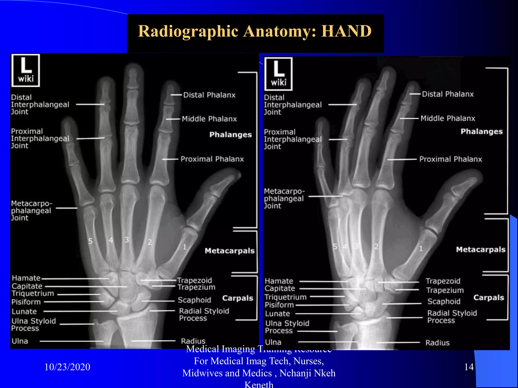 X ray of the upper limbs radiology raining resource nchanji nkeh keneth ...