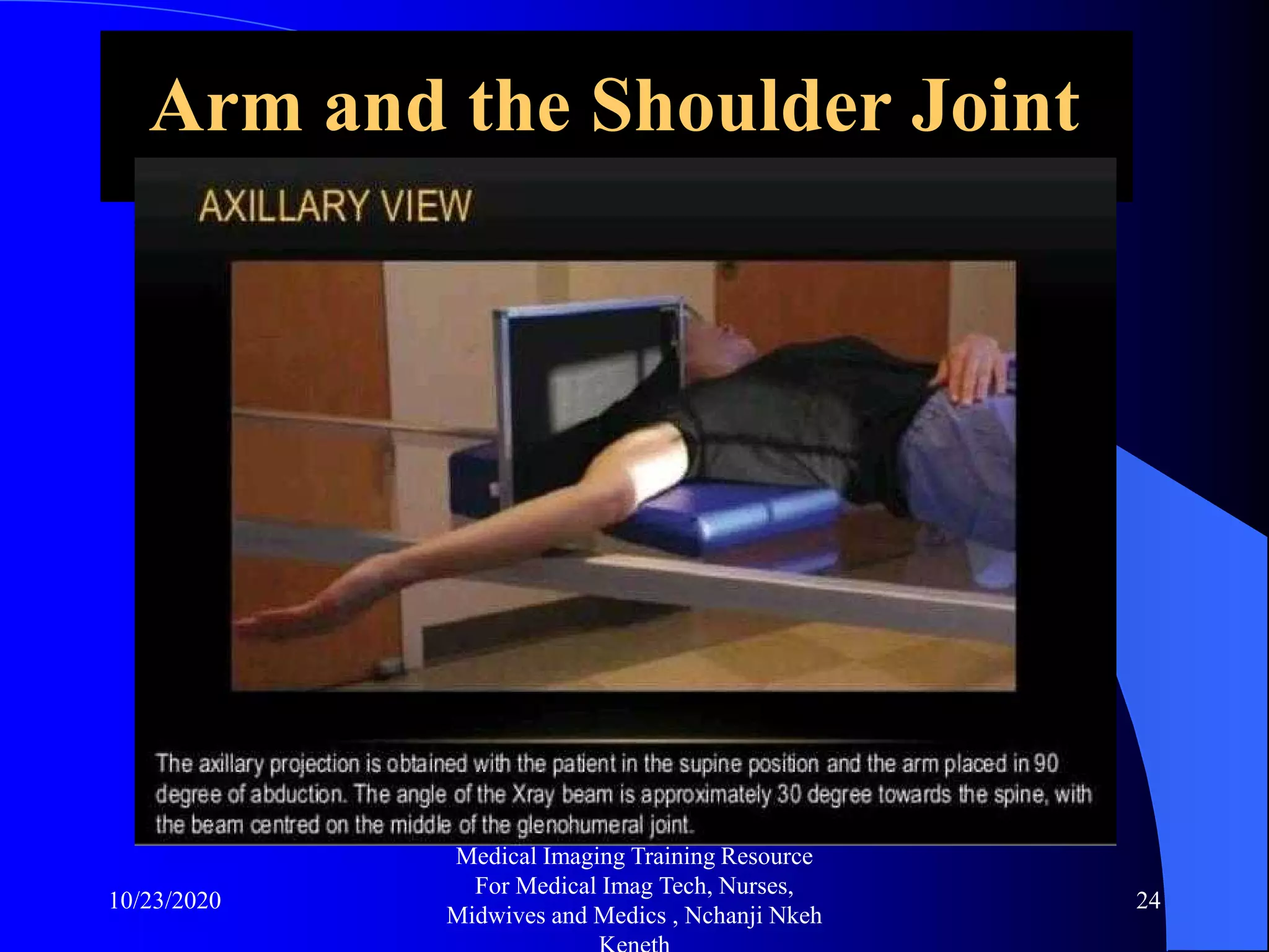 X ray of the upper limbs radiology raining resource nchanji nkeh keneth ...