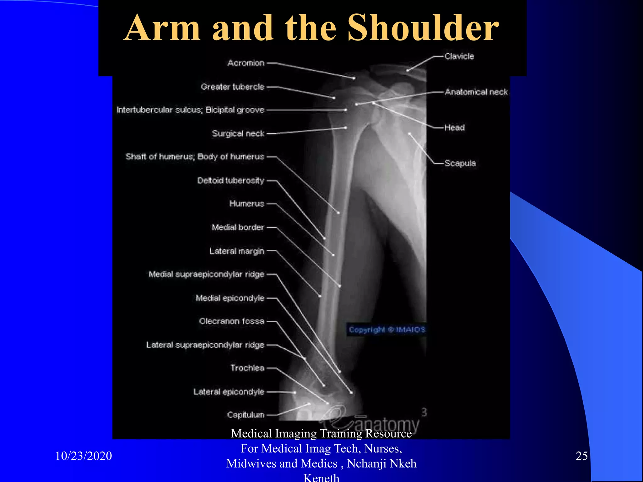 X ray of the upper limbs radiology raining resource nchanji nkeh keneth ...