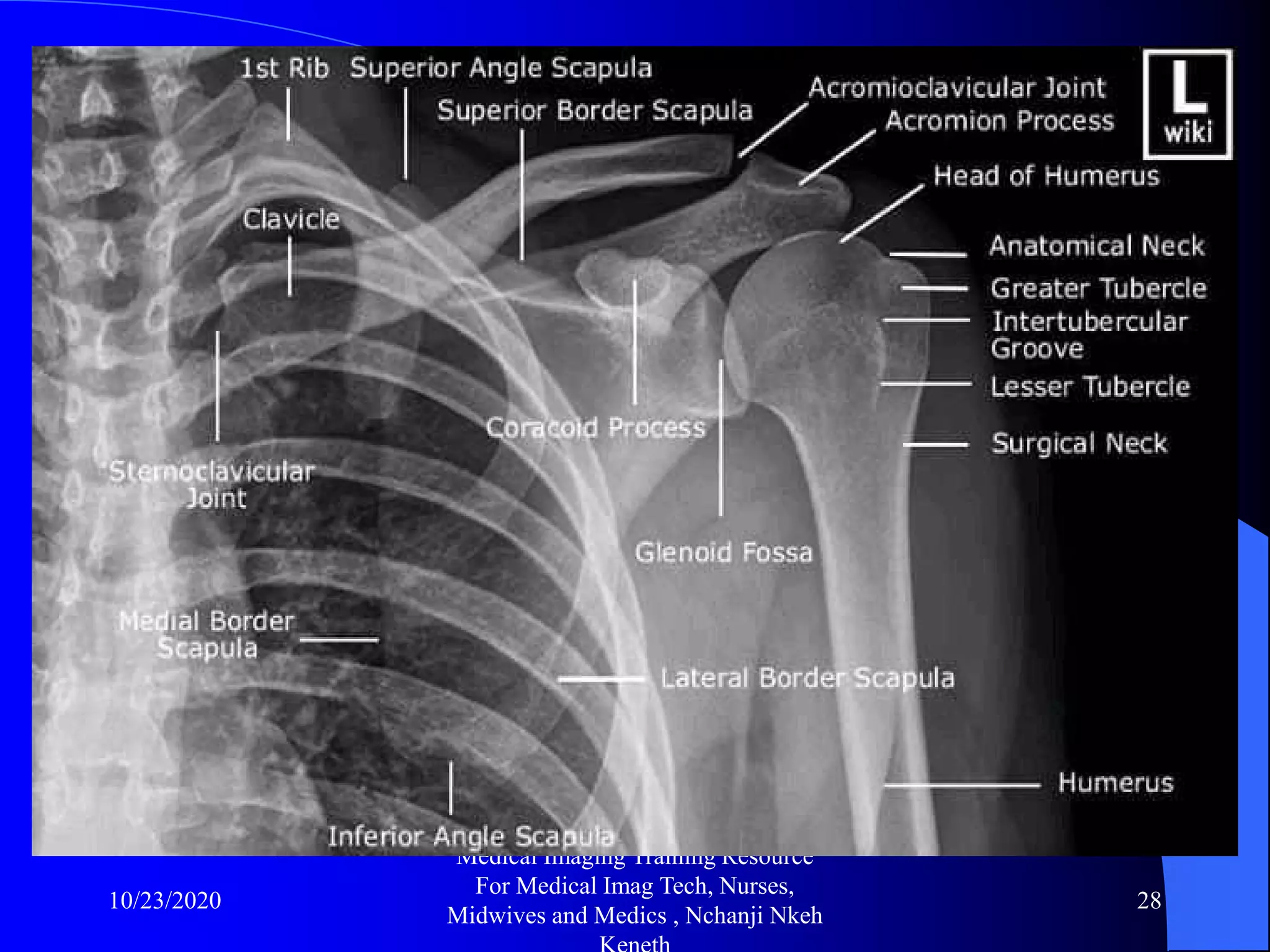 X ray of the upper limbs radiology raining resource nchanji nkeh keneth ...