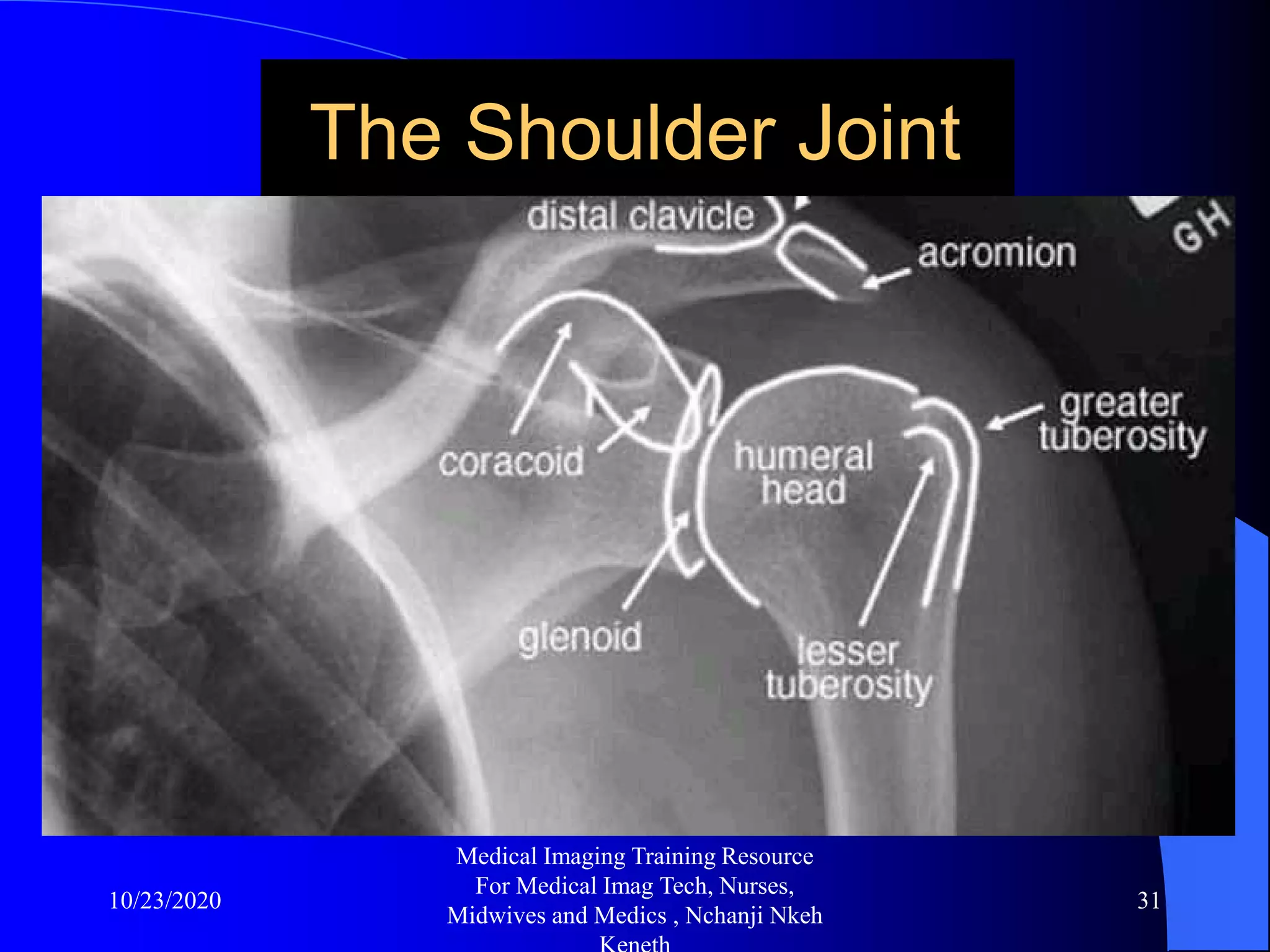 X ray of the upper limbs radiology raining resource nchanji nkeh keneth ...