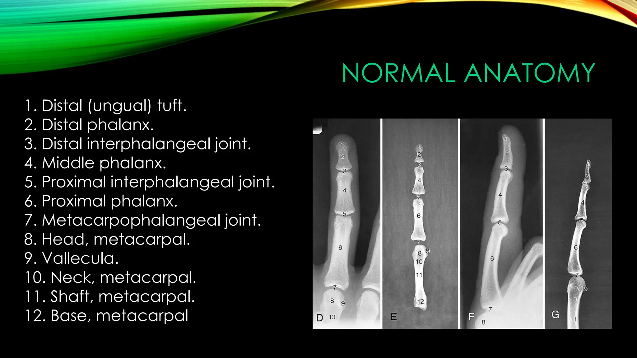 x-rayofwristandhand-190421102433ccc.pptx