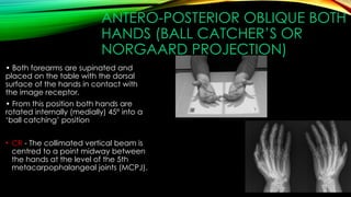 x-rayofwristandhand-190421102433ccc.pptx