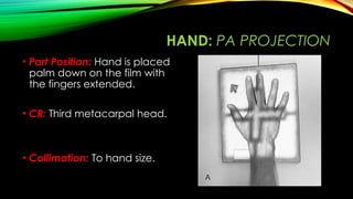 x-rayofwristandhand-190421102433ccc.pptx