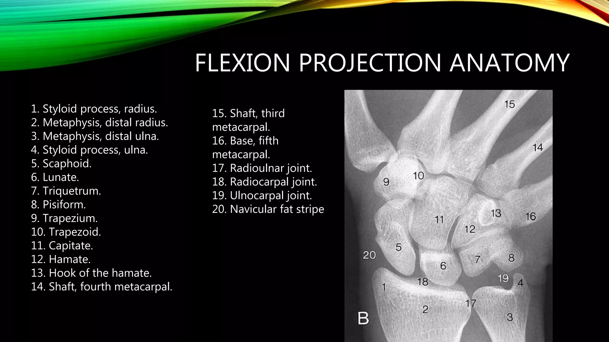 X ray of wrist and hand | PPTX