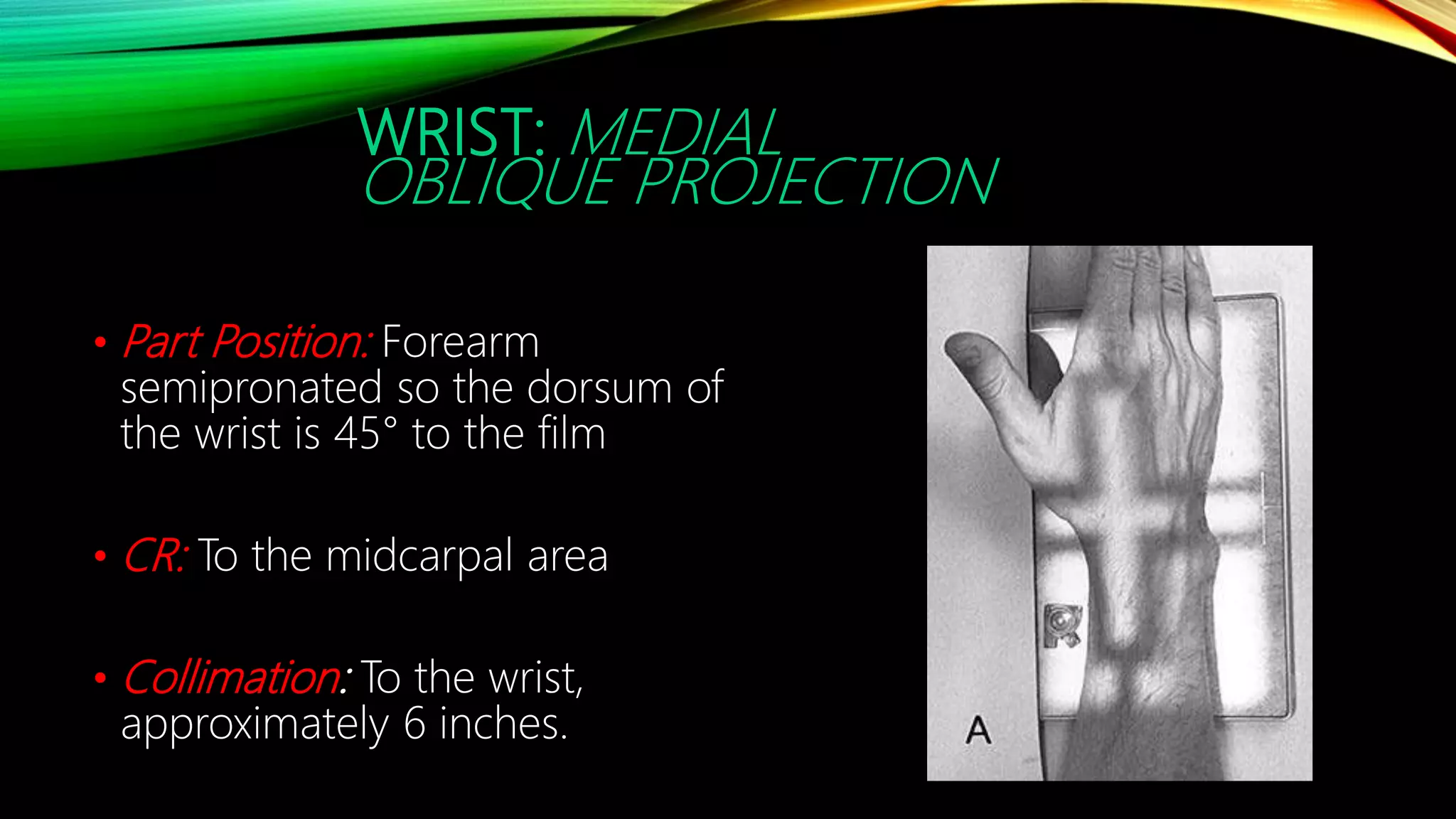 X ray of wrist and hand | PPTX
