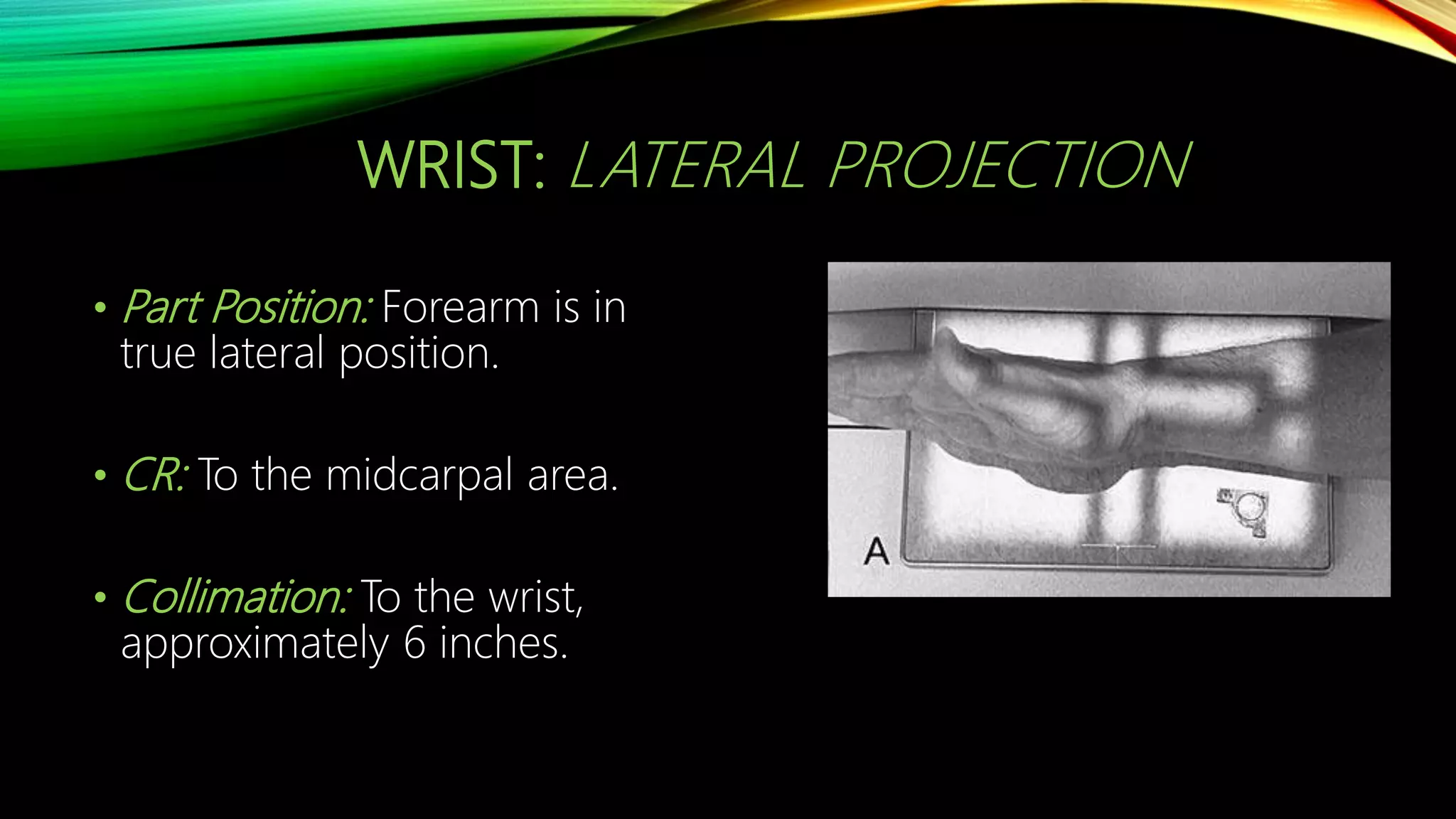 X ray of wrist and hand | PPTX