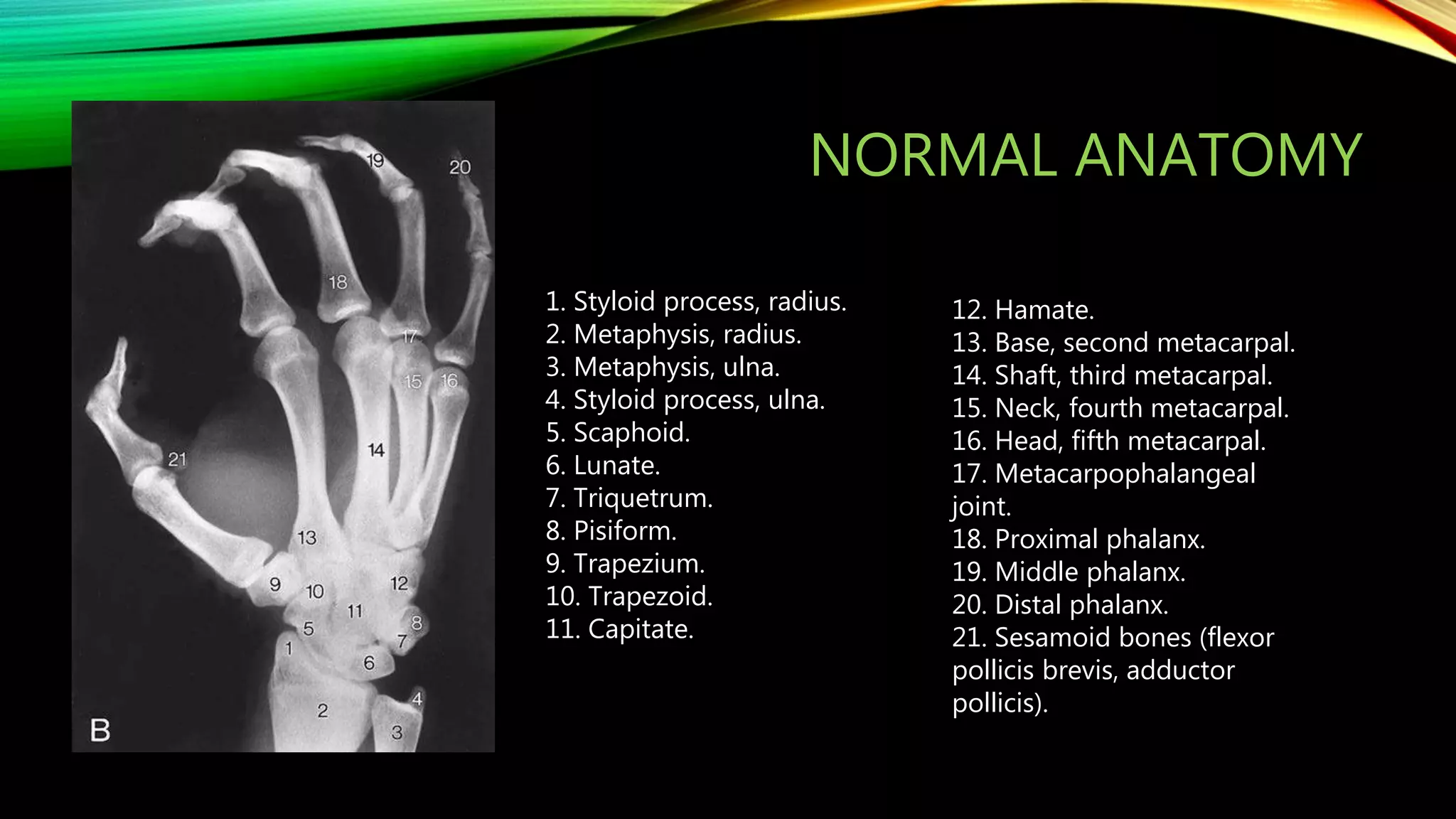 X ray of wrist and hand | PPTX