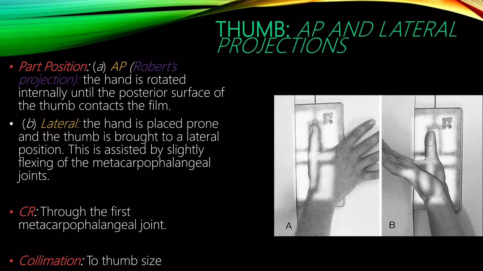 X ray of wrist and hand | PPTX