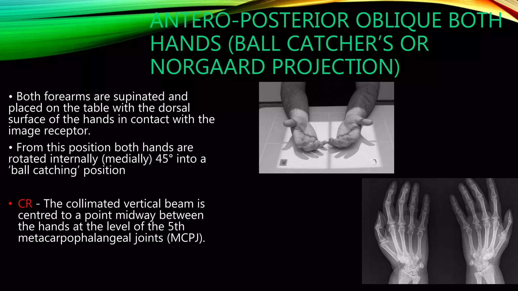 X ray of wrist and hand | PPTX