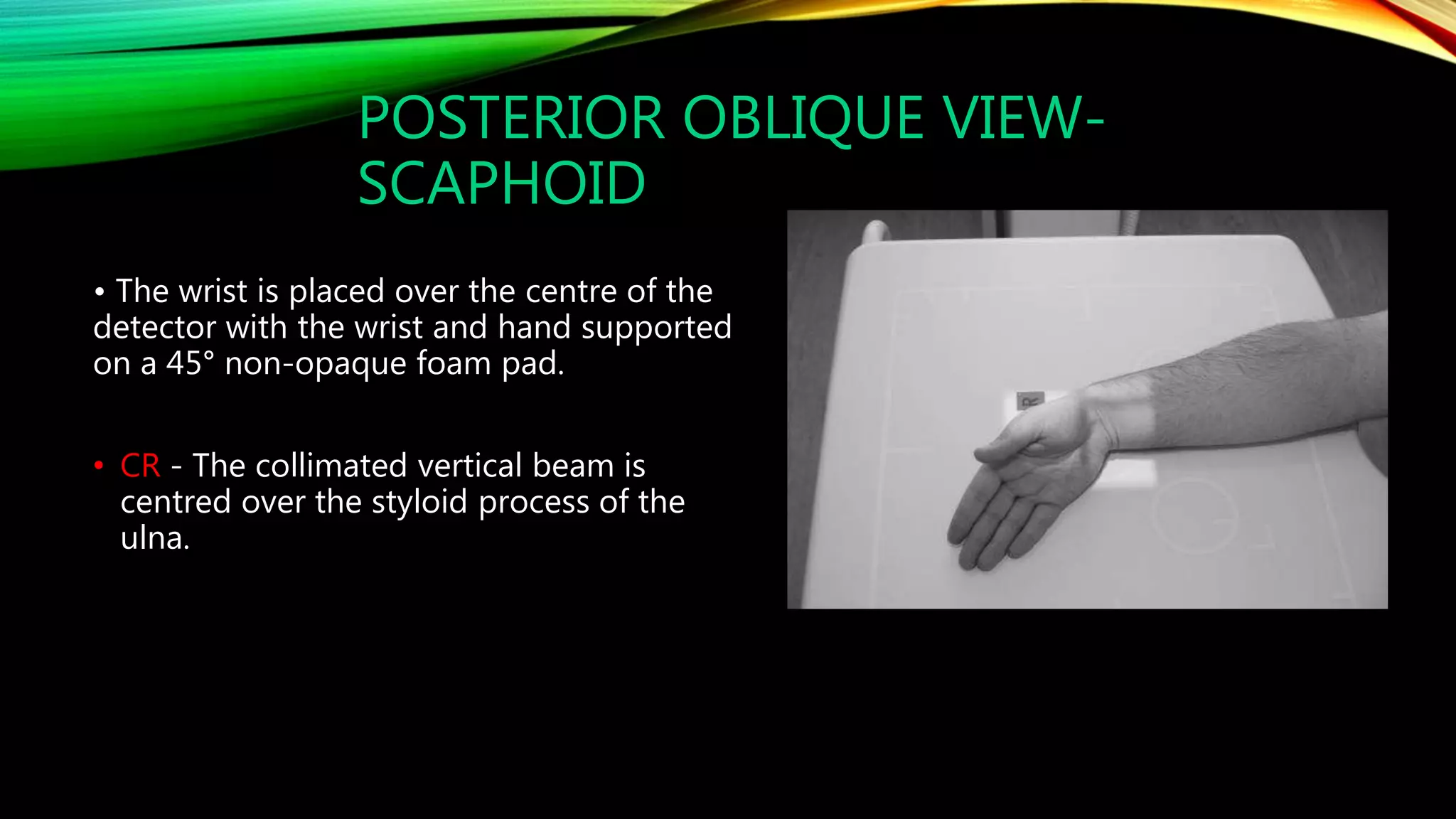 X ray of wrist and hand | PPTX