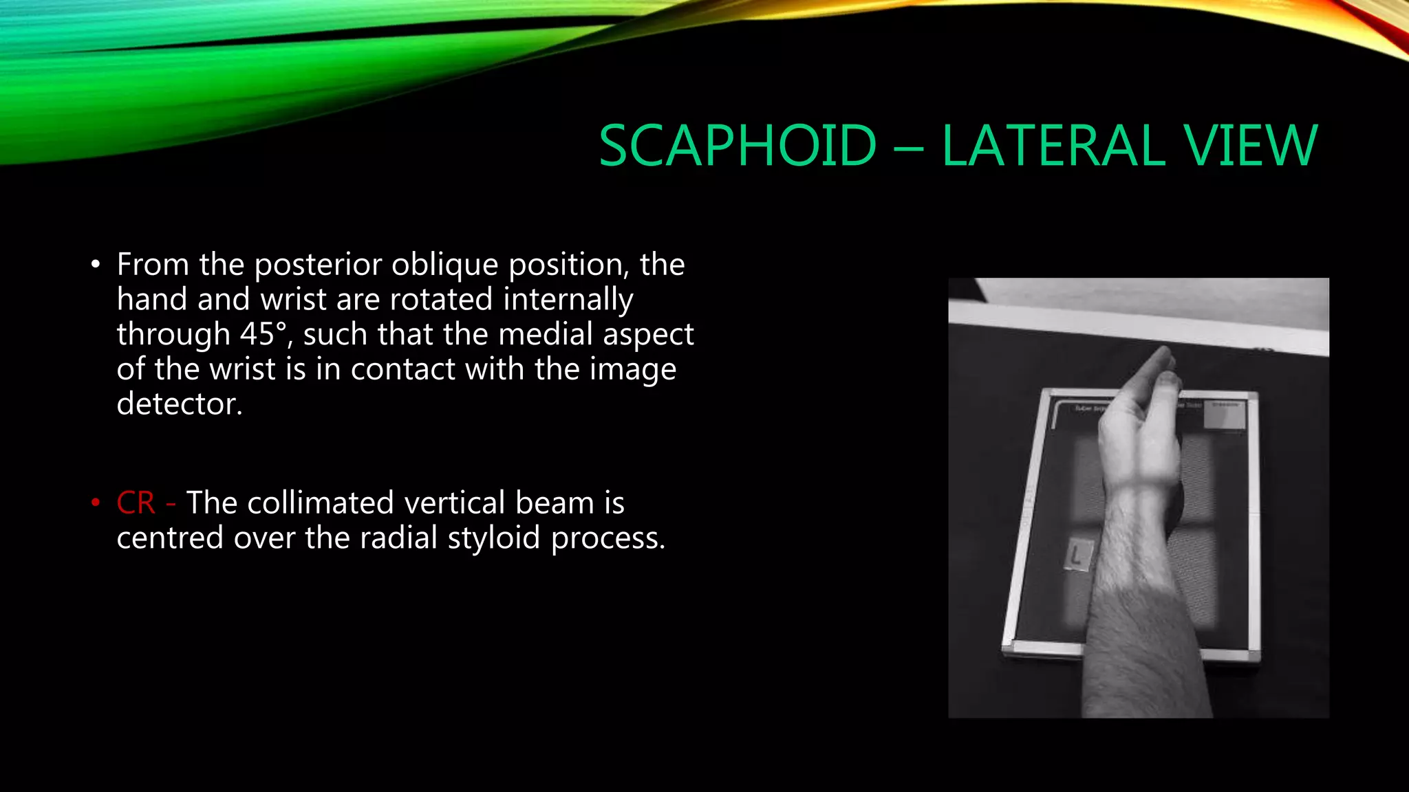 X ray of wrist and hand | PPTX